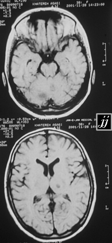 Brain – Anatomy (150) – Radioogle