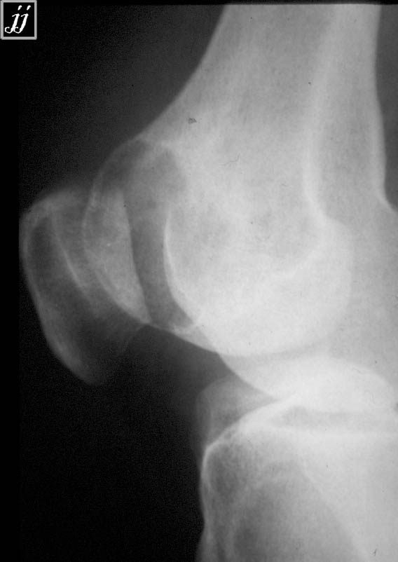 MSK – normal anatomy - Radioogle