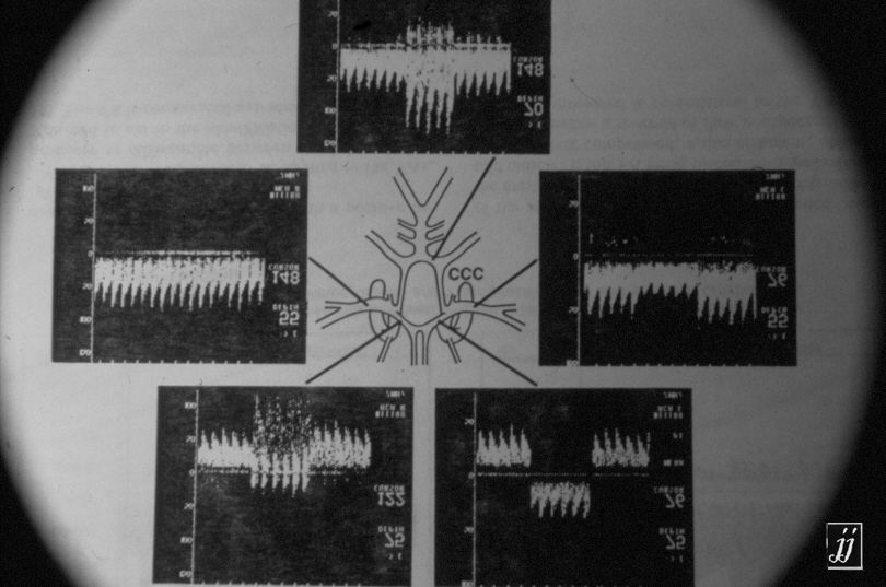 US- TCD diagram - Radioogle