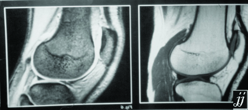 MSK- knee anatomy - Radioogle